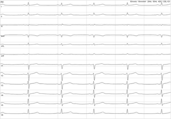 Elektrokardiographie – cardiologen.de